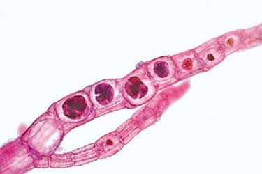 Slide, Polysiphonia, Marine Species, w.m | Flinn Scientific